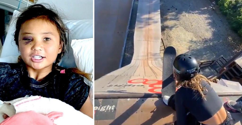 Tony Hawk Helps 12yo Skater Return From Injury, Conquer Mega Ramp